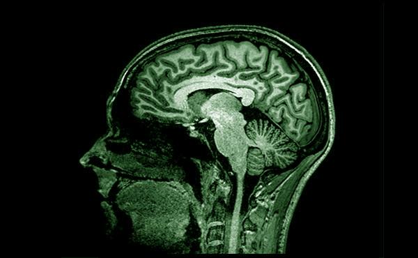 Neuroimaging research group | BBRC